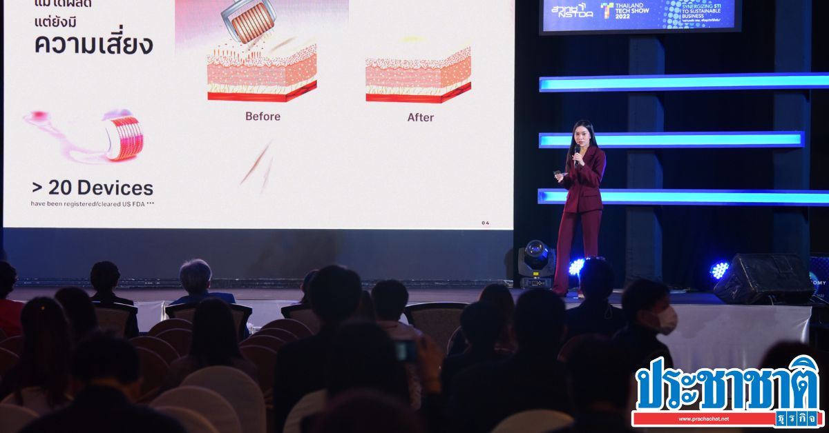 แผ่นแปะปรับสภาพผิวเรียบเนียน คว้าผลงานวิจัยที่น่าลงทุนที่สุดปี 2022