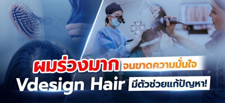 ผมร่วงมากจนขาดความมั่นใจ Vdesign Hair มีตัวช่วยแก้ปัญหา
