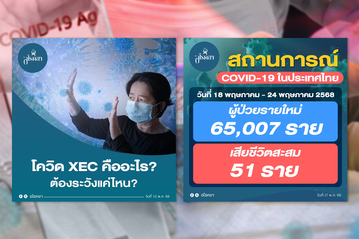 โควิดวันนี้ (27 พ.ค. 68) ป่วยใหม่พุ่ง 6.5 หมื่นราย ป่วยสะสมทะลุ 2 แสนคน